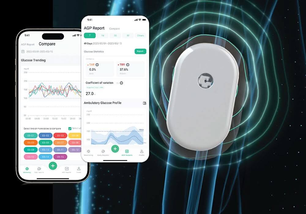 SIBIONICS GS1 CGM Continuous Glucose Monitoring System